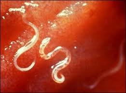 Les parasitoses intestinales: comment aborder le problème? | SantiShop